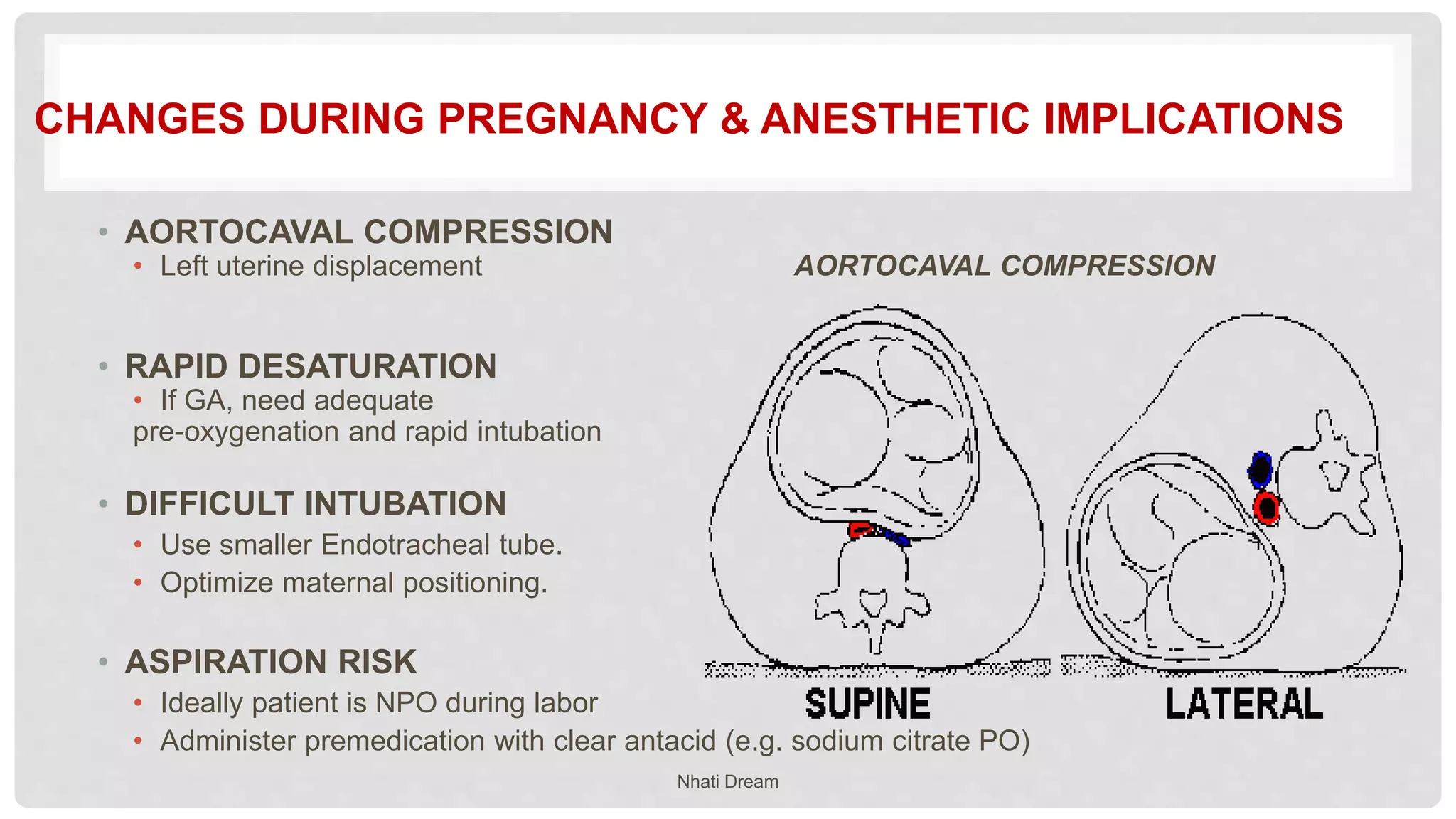 Obstetric Anesthesia ppt [ Natnael Dechasa ].pptx
