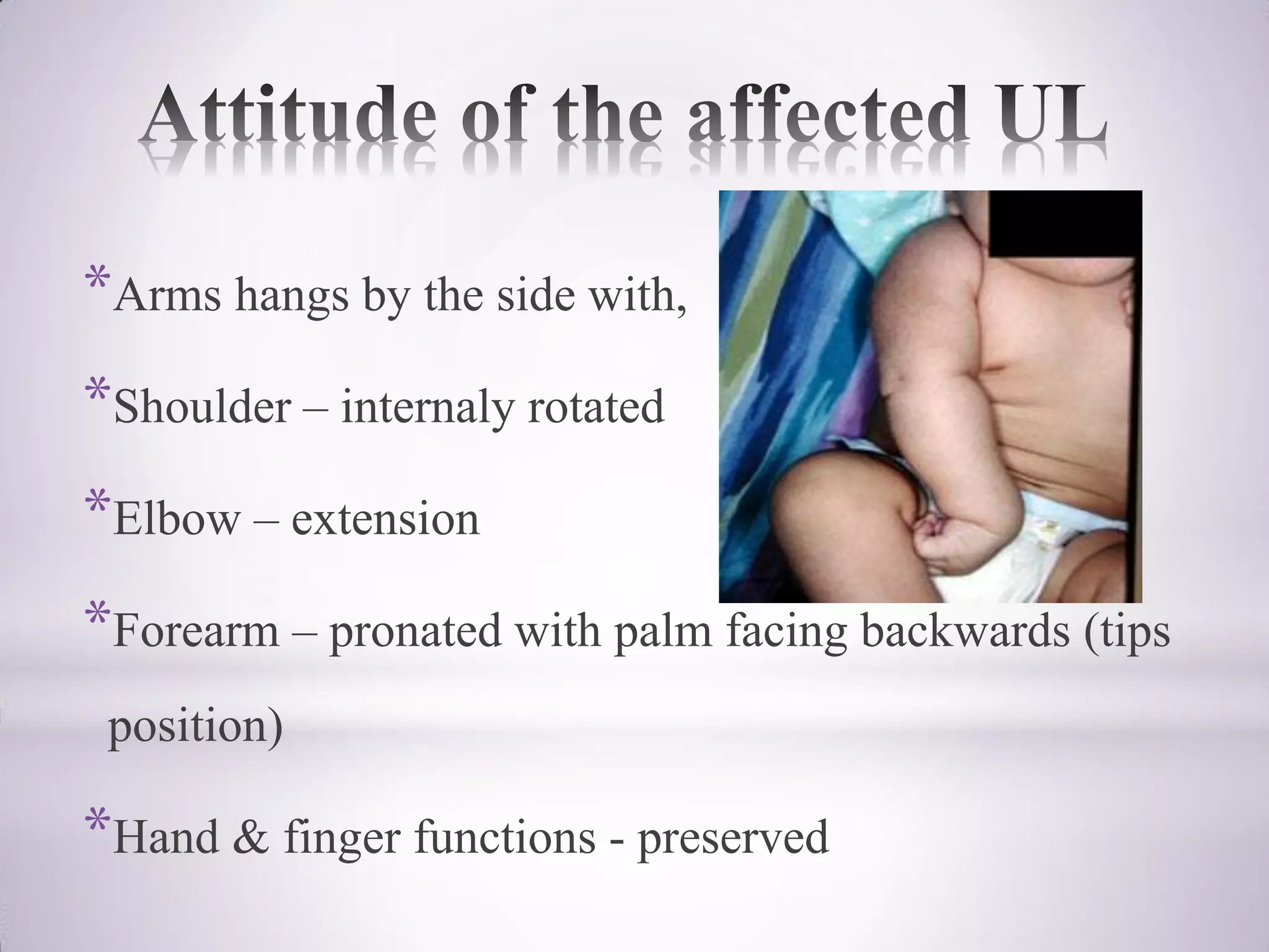 Obstetric brachial plexus injury (OBPI) | PDF