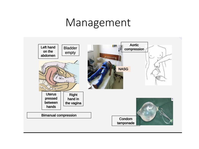 Obstetric emergencies for emergency medical officers | PPT