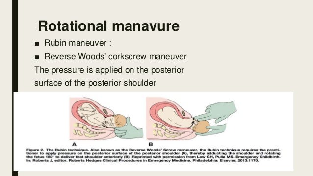 Obstetric emergencies