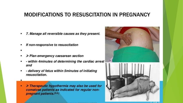 OBSTETRIC EMERGENCY EDITED.pptx