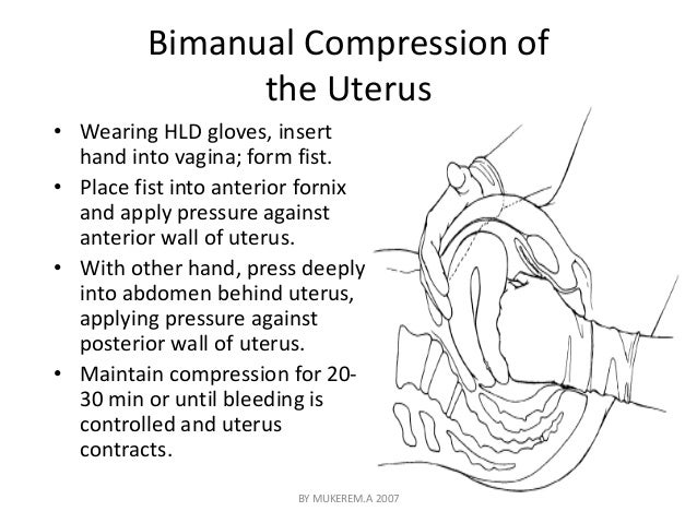 Obstetric emergency part 2