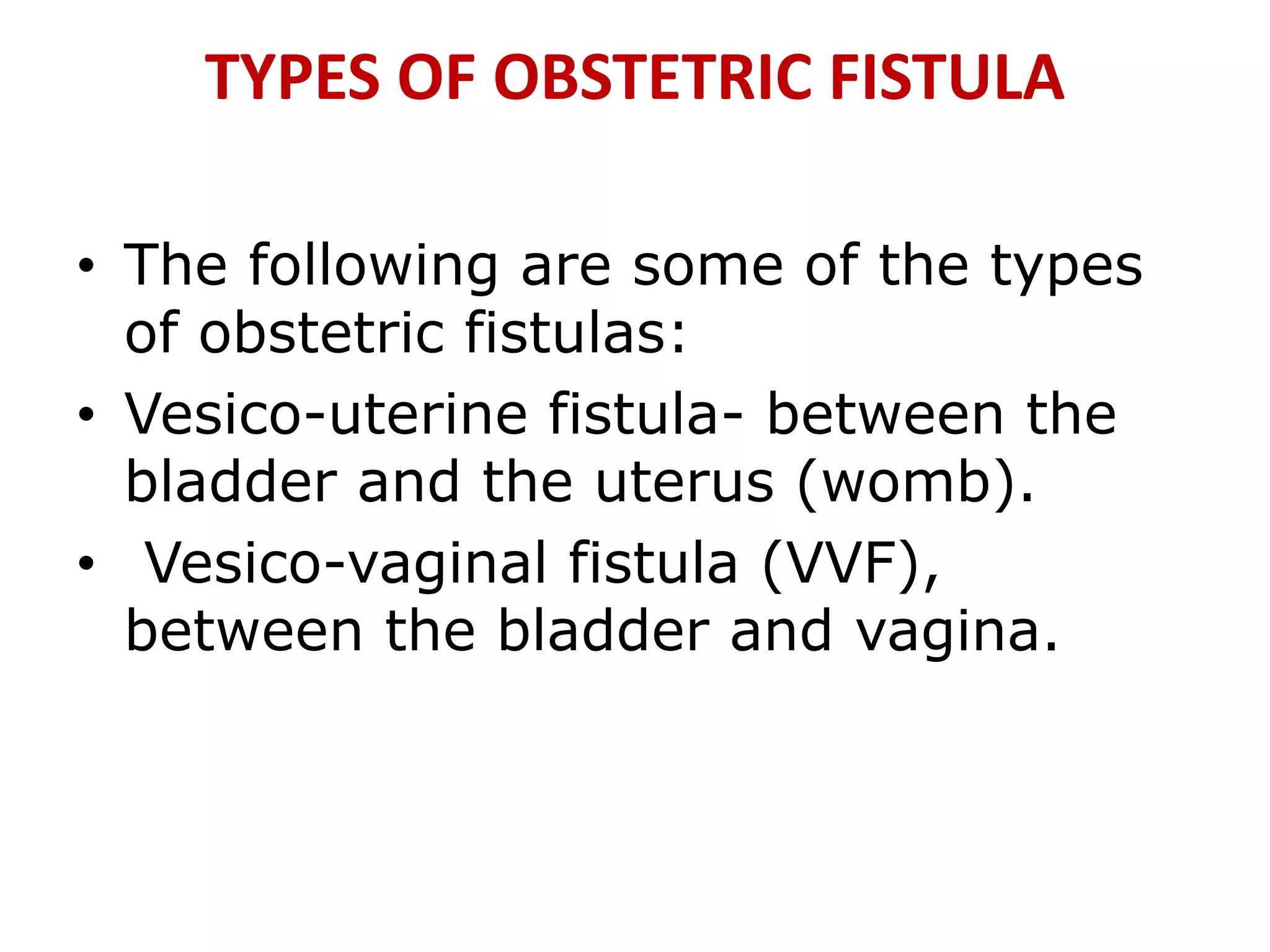 OBSTETRIC FISTULA.pptx