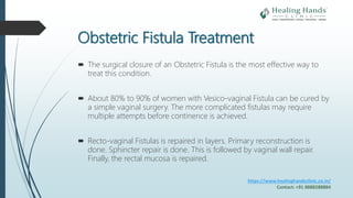 Obstetric Fistula: Causes, Symptoms and Treatment | PPTX
