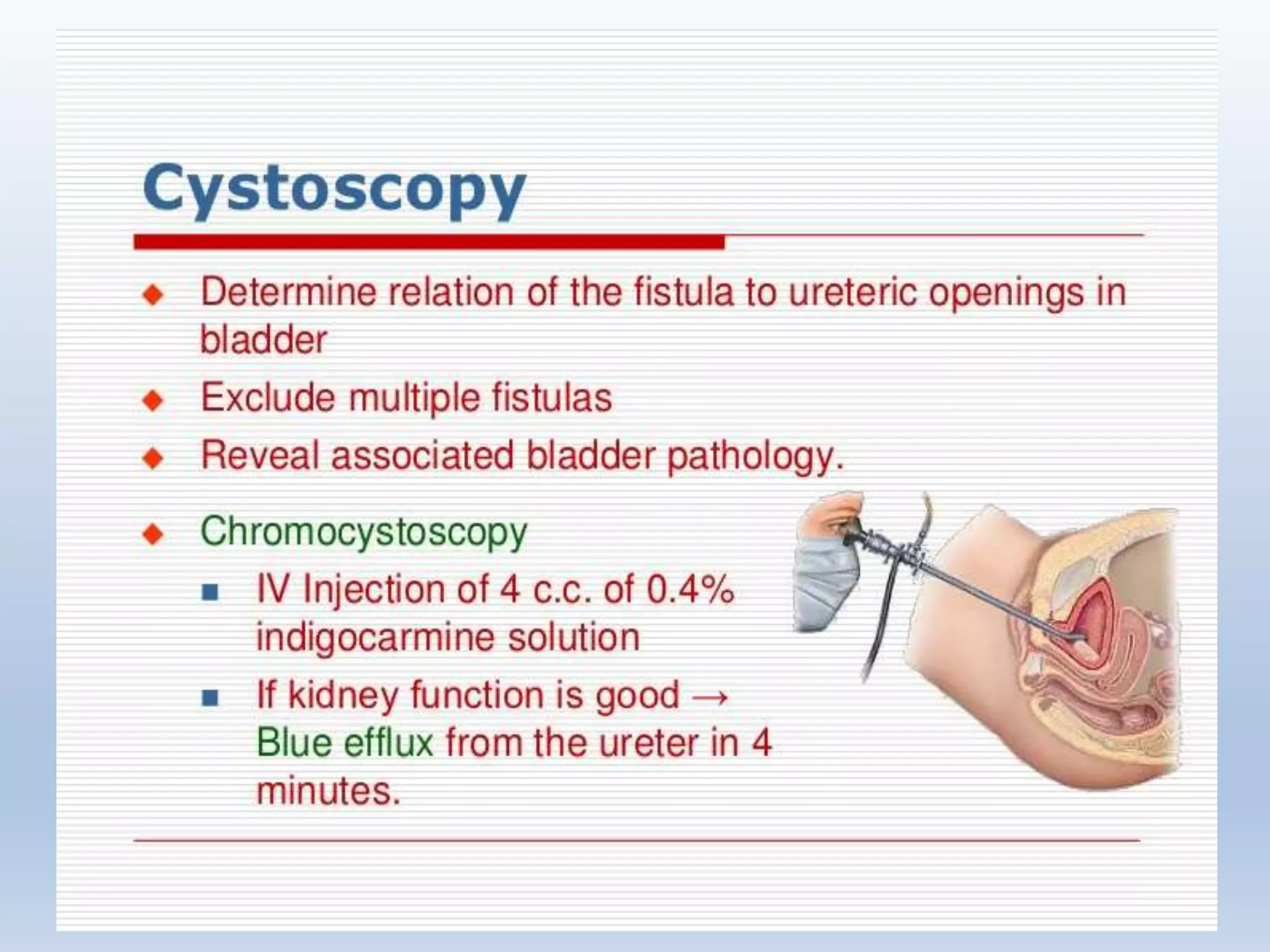 Obstetric fistulae | PPTX