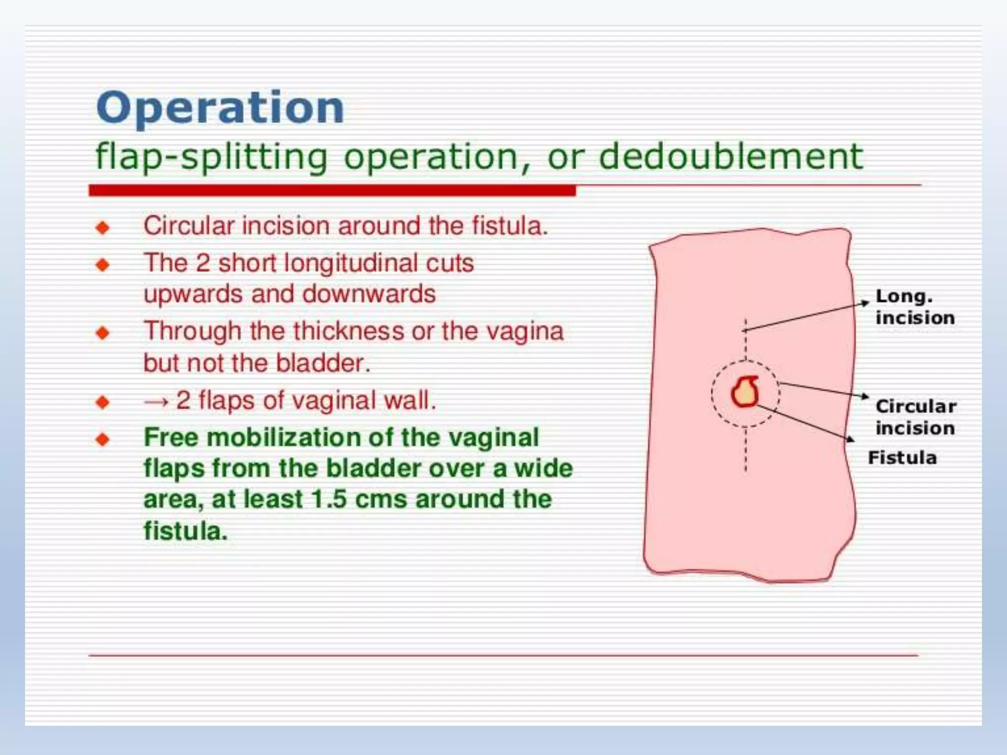 Obstetric fistulae | PPTX