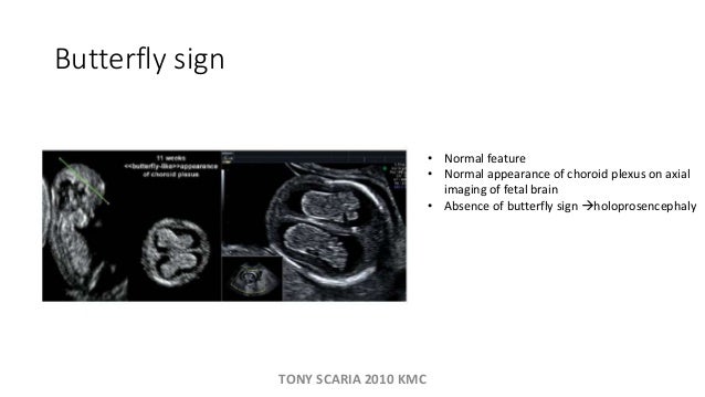 Obstetric & gynaec radiology revision notes