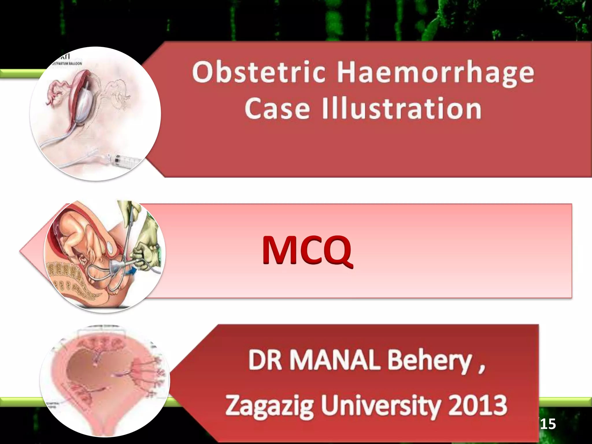 Obstetric hemorrhage cases and MCQ for undergraduate | PPSX