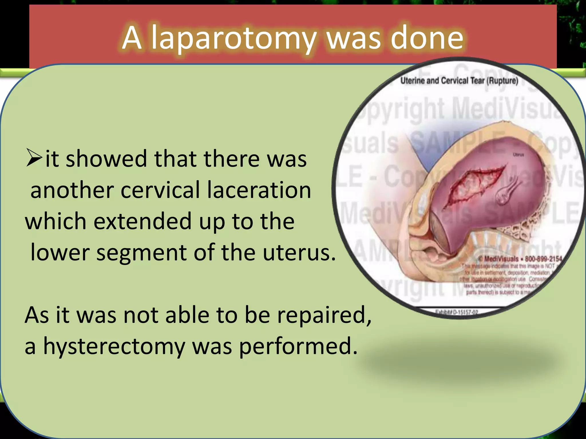 Obstetric hemorrhage cases and MCQ for undergraduate | PPSX