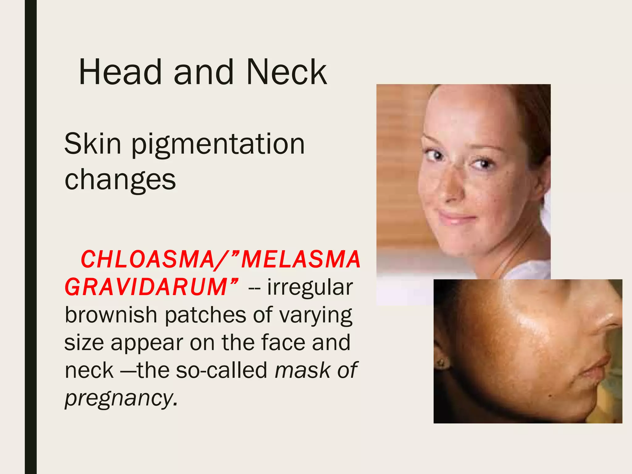 Obstetric history and pe dr ina irabon | PPT