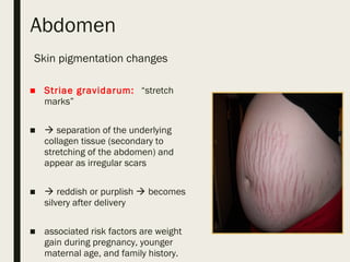 Obstetric history and pe dr ina irabon | PPT