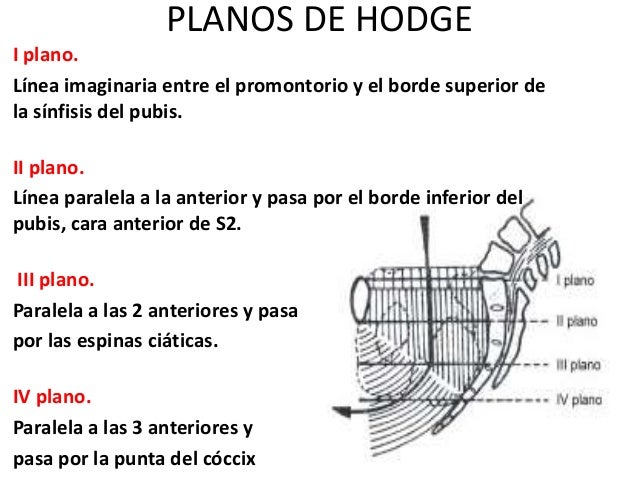 Planos De Hodge