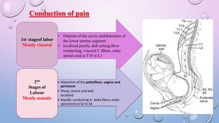 OBSTETRICIAN’s PERSPECTIVE OF LABOUR ANALGESIA.pptx