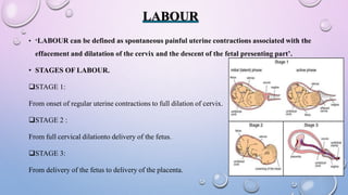 OBSTETRICIAN’s PERSPECTIVE OF LABOUR ANALGESIA.pptx