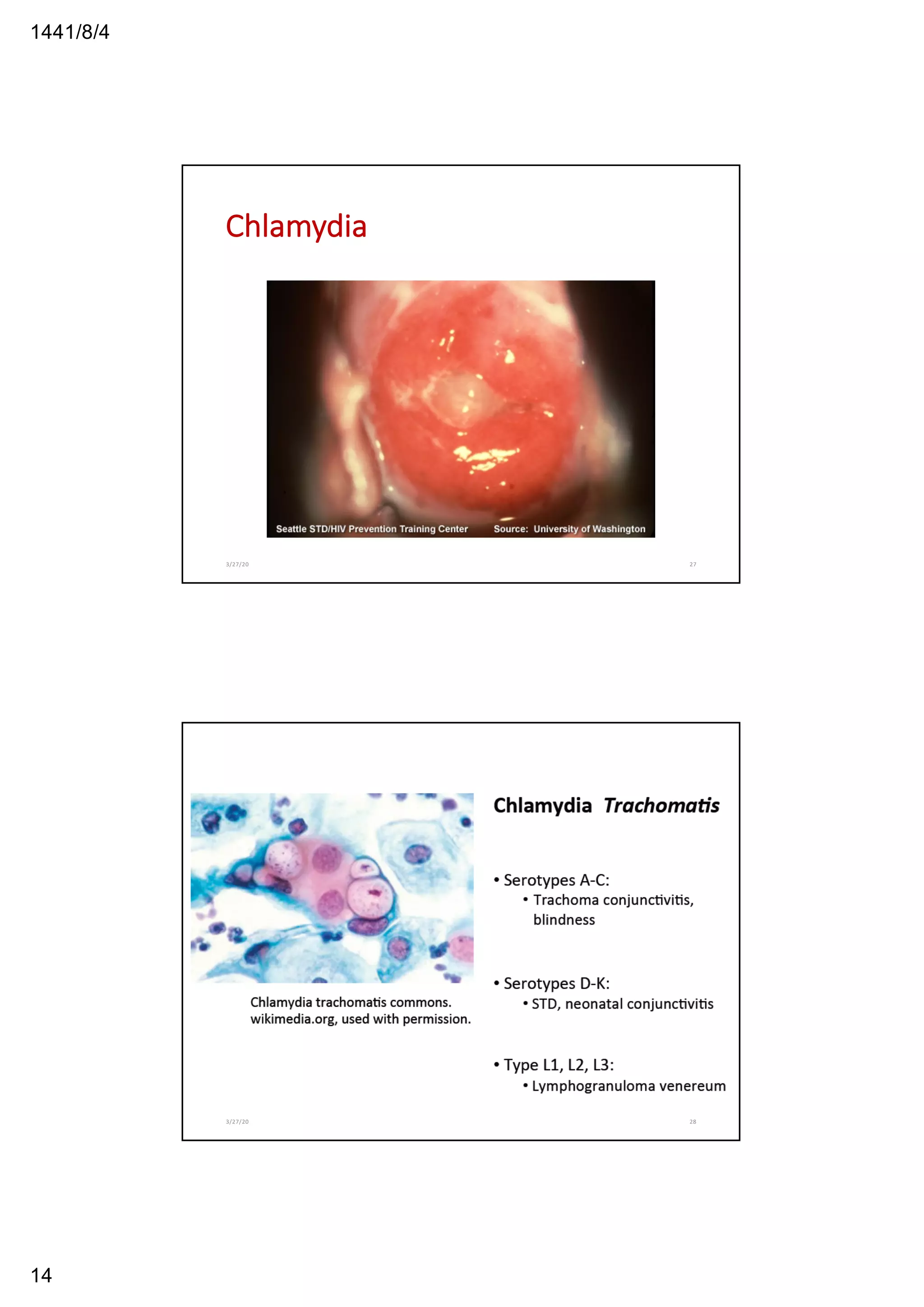 Obstetrics and gynaecology infections 2 | PDF