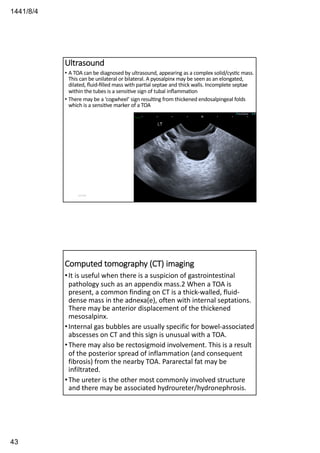 Obstetrics and gynaecology infections 2 | PDF