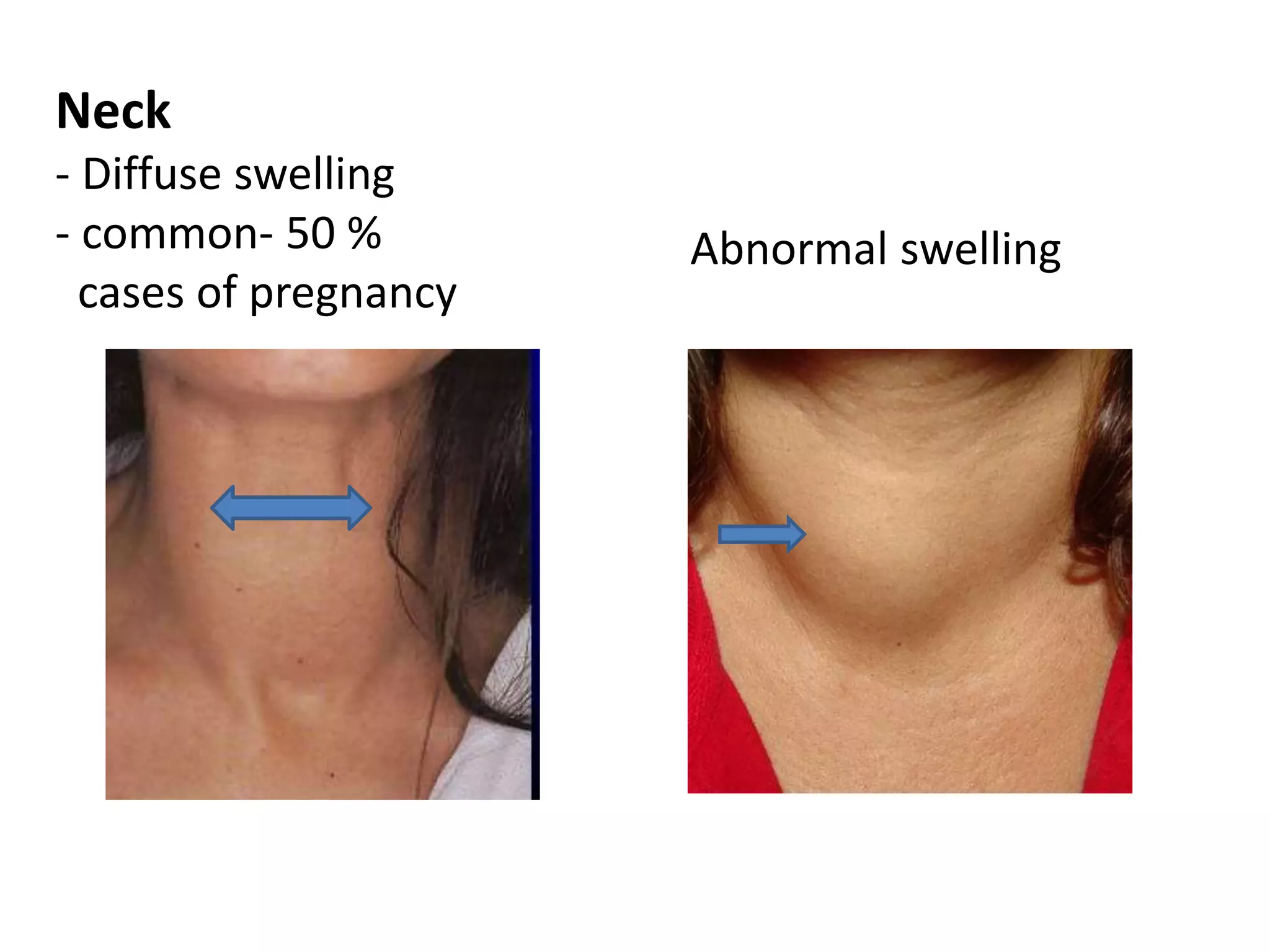 Obstetrics History taking/ Examination | PPTX