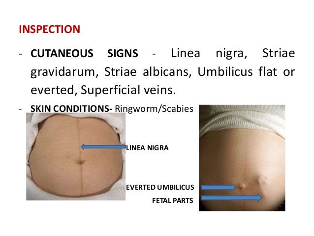 Obstetrics History taking/ Examination