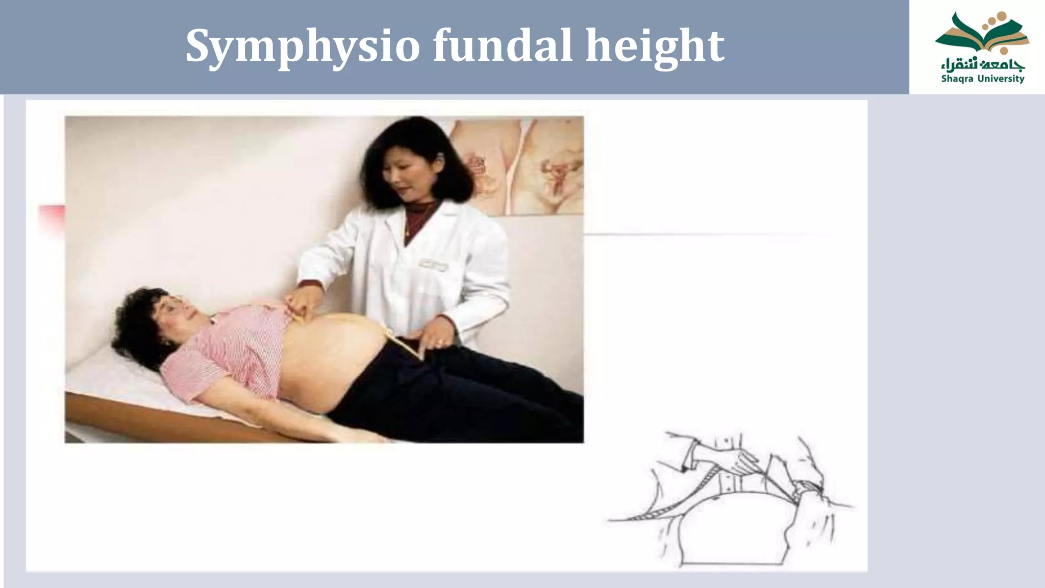 obstetrics examination .pptx