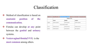Obstetrics fistula.pptx