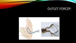 OBSTETRICS FORCEPS на портал.pptx