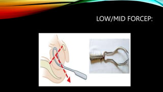 OBSTETRICS FORCEPS на портал.pptx