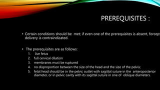 OBSTETRICS FORCEPS на портал.pptx