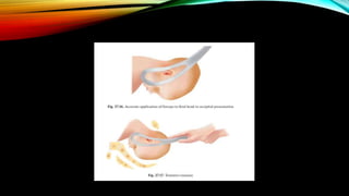OBSTETRICS FORCEPS на портал.pptx