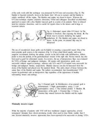 Obstetrics gynecology articles | DOCX