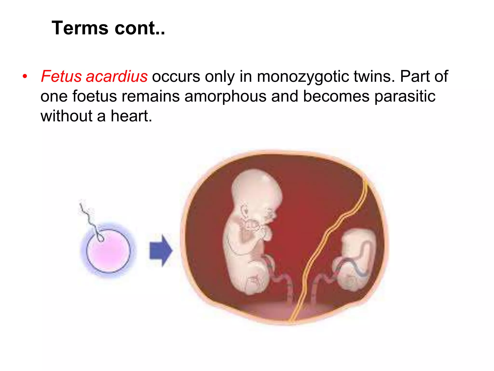 Multiple pregnancy | PPTX