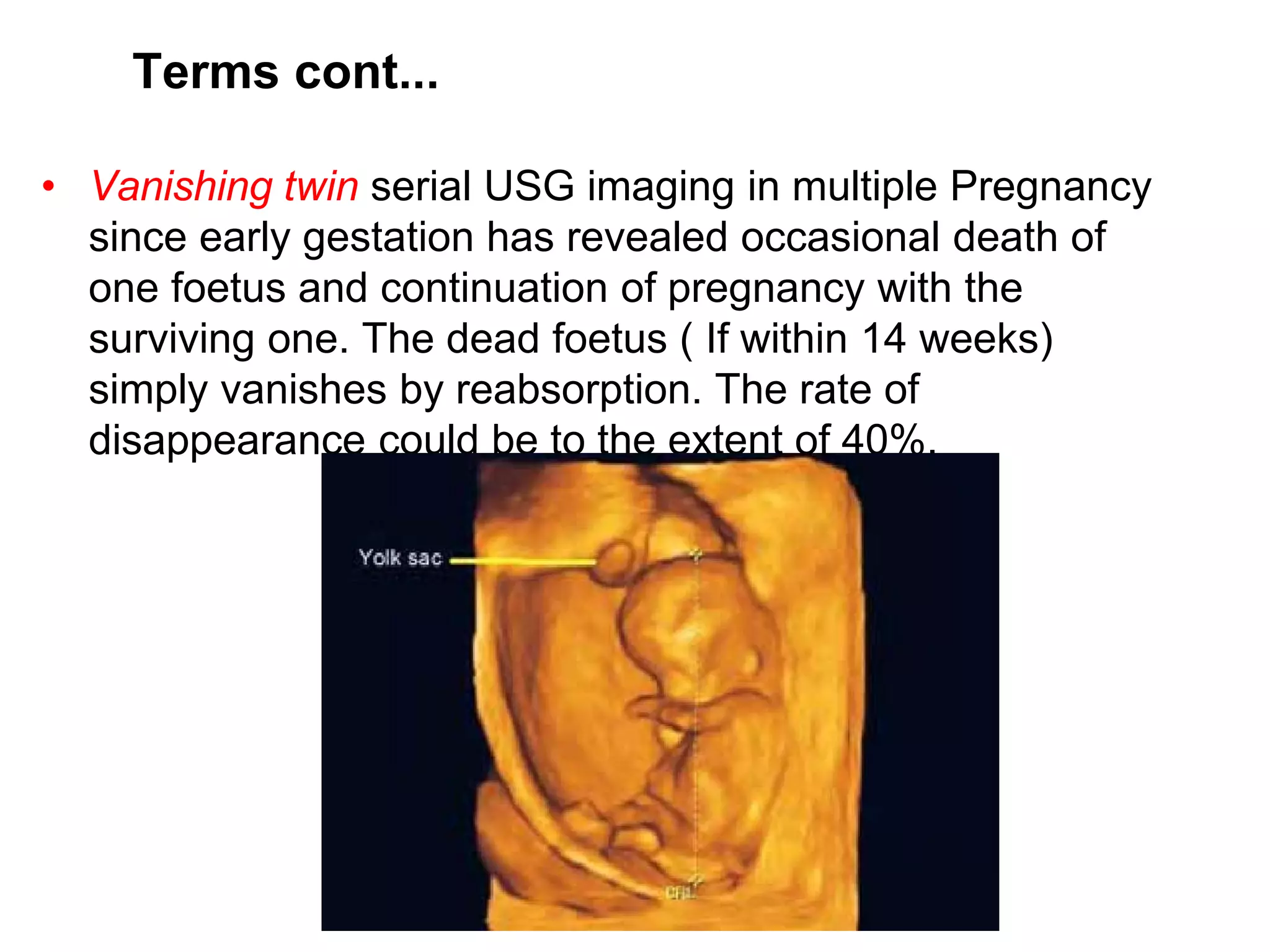 Multiple pregnancy | PPTX