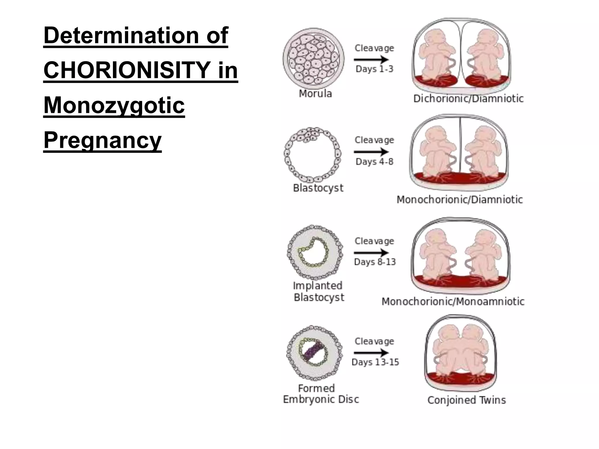 Multiple pregnancy | PPTX