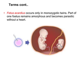 Multiple pregnancy | PPTX