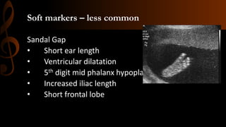 Obstetrics ultrasound for postgrad 1 | PPTX