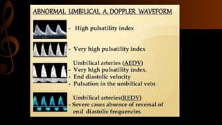 Obstetrics ultrasound for postgrad 1 | PPTX