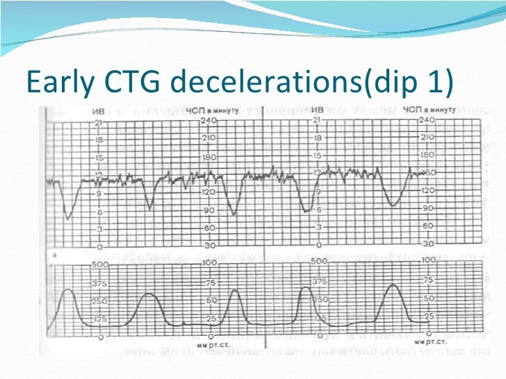 Obstetric terminology