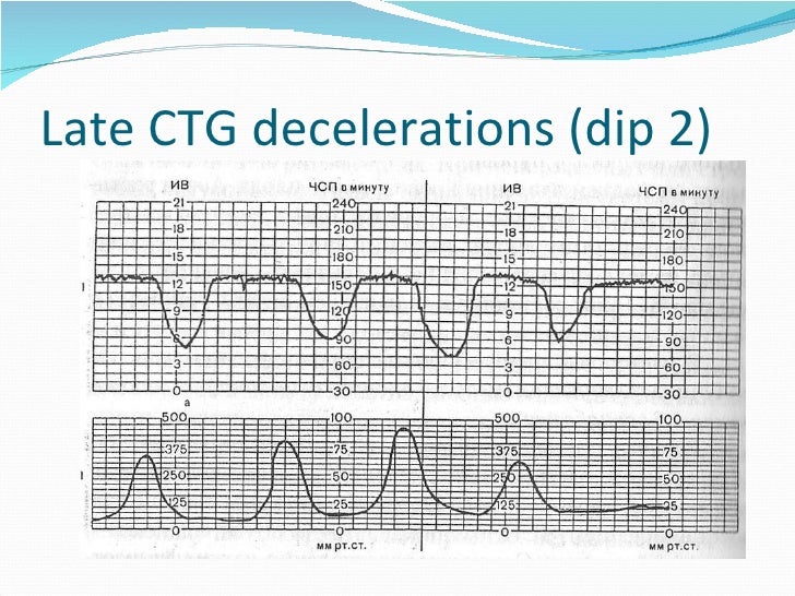 Obstetric terminology