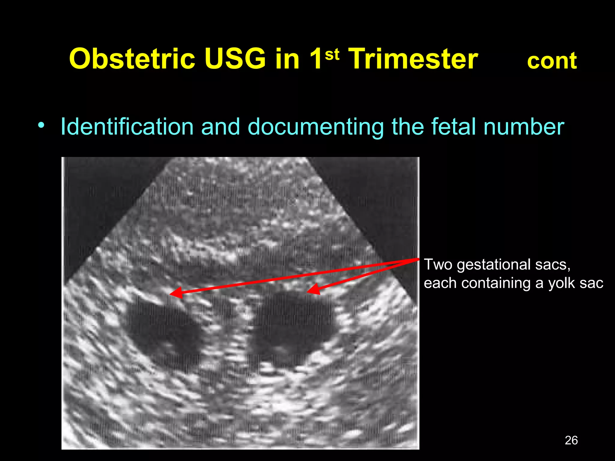 Obstetric ultrasound | PPT