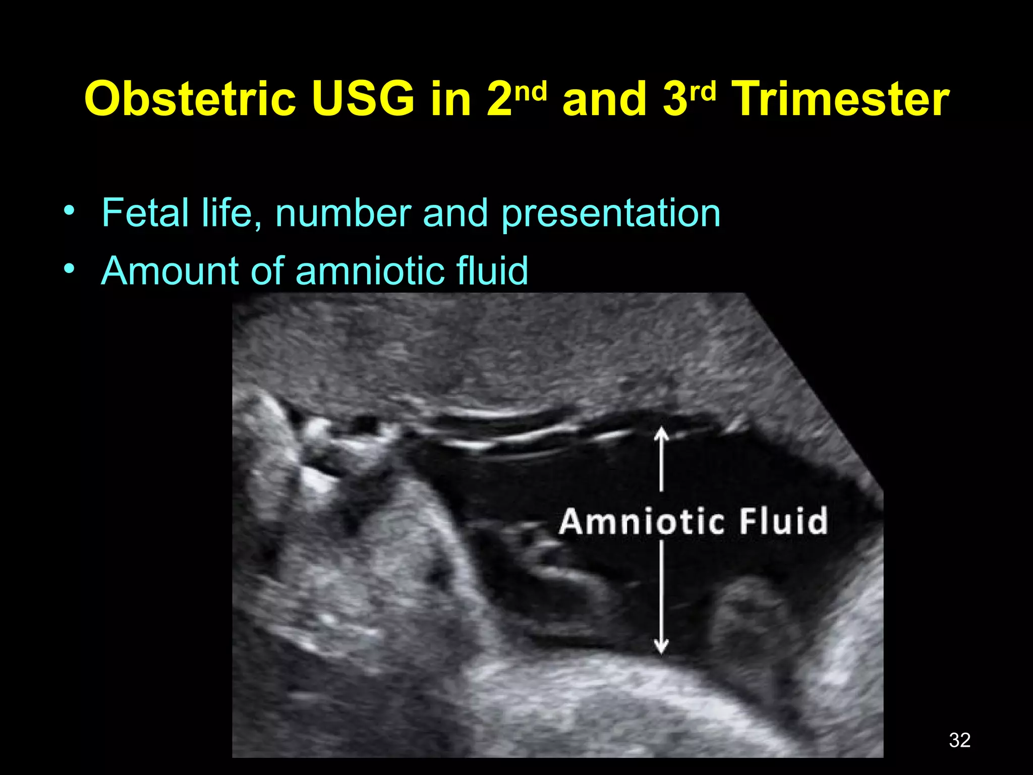 Obstetric ultrasound | PPT