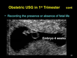 Obstetric ultrasound | PPT