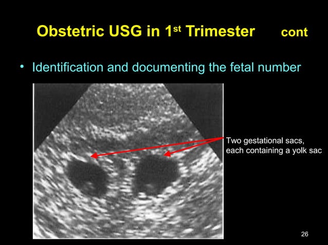 Obstetric ultrasound | PPT
