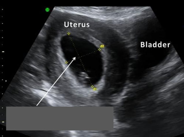 Obstetric ultrasound | PPT