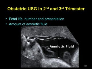 Obstetric ultrasound | PPT
