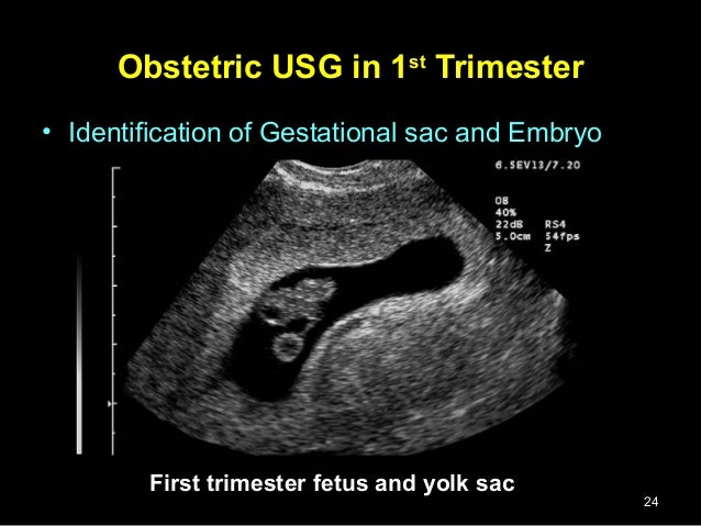 Obstetric ultrasound