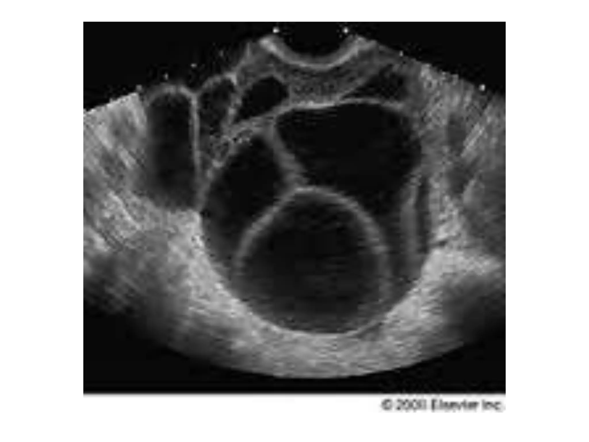 obstetric ultrasound.ppt