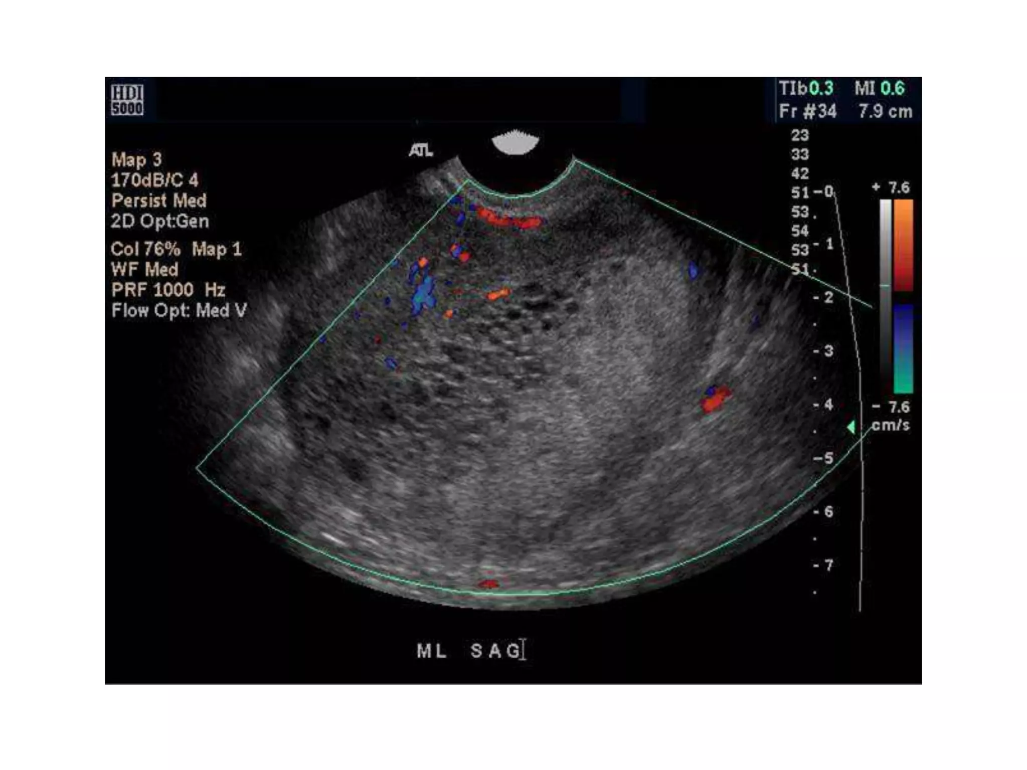 obstetric ultrasound.ppt