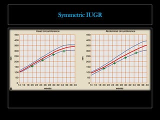Obstetric Ultrasound -Lecture 09 -Fetal growth.pdf