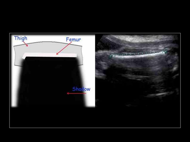 Obstetric Ultrasound -Lecture 09 -Fetal growth.pdf