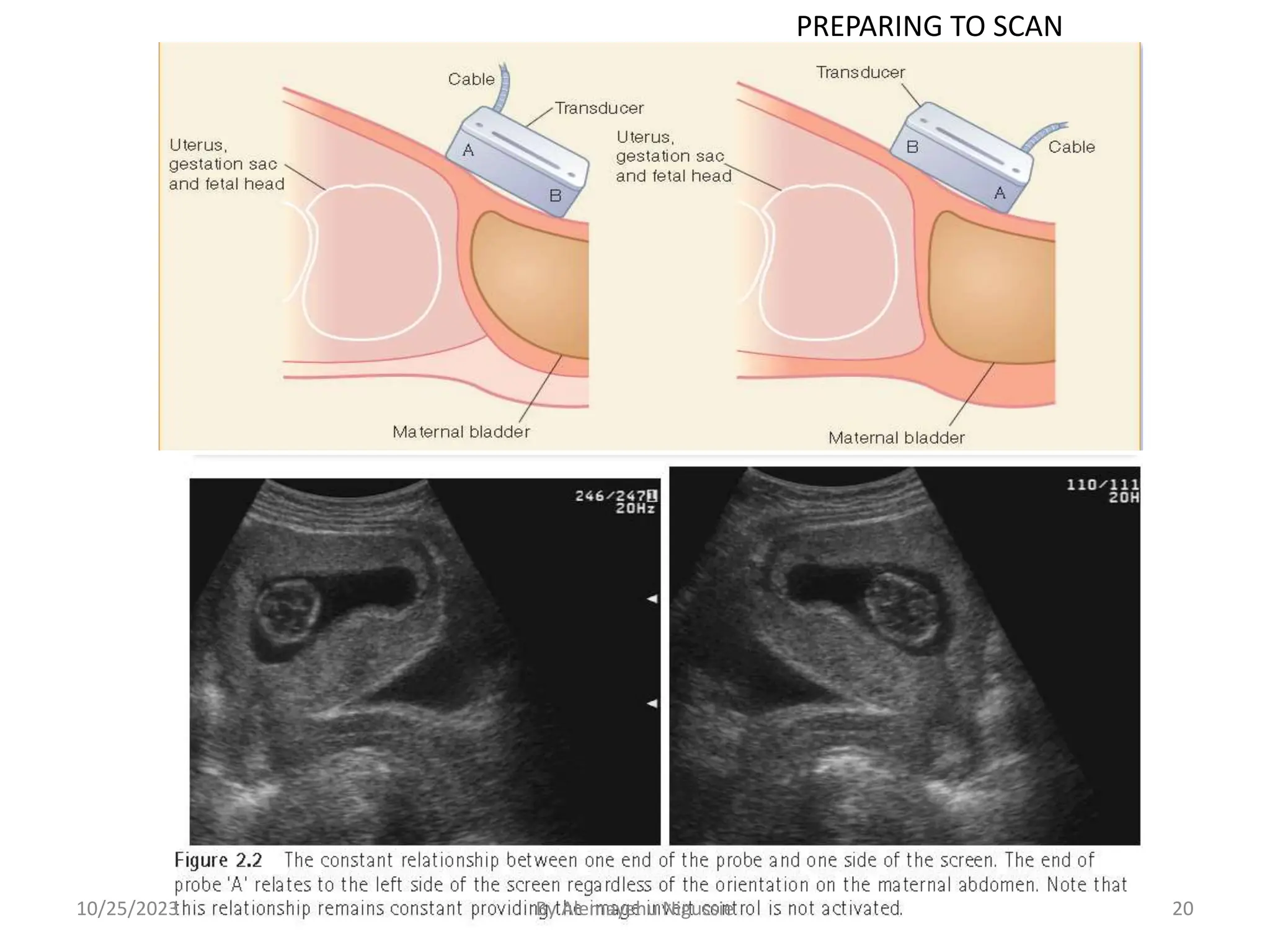 Obstetric Ultrasound final-1.pptx