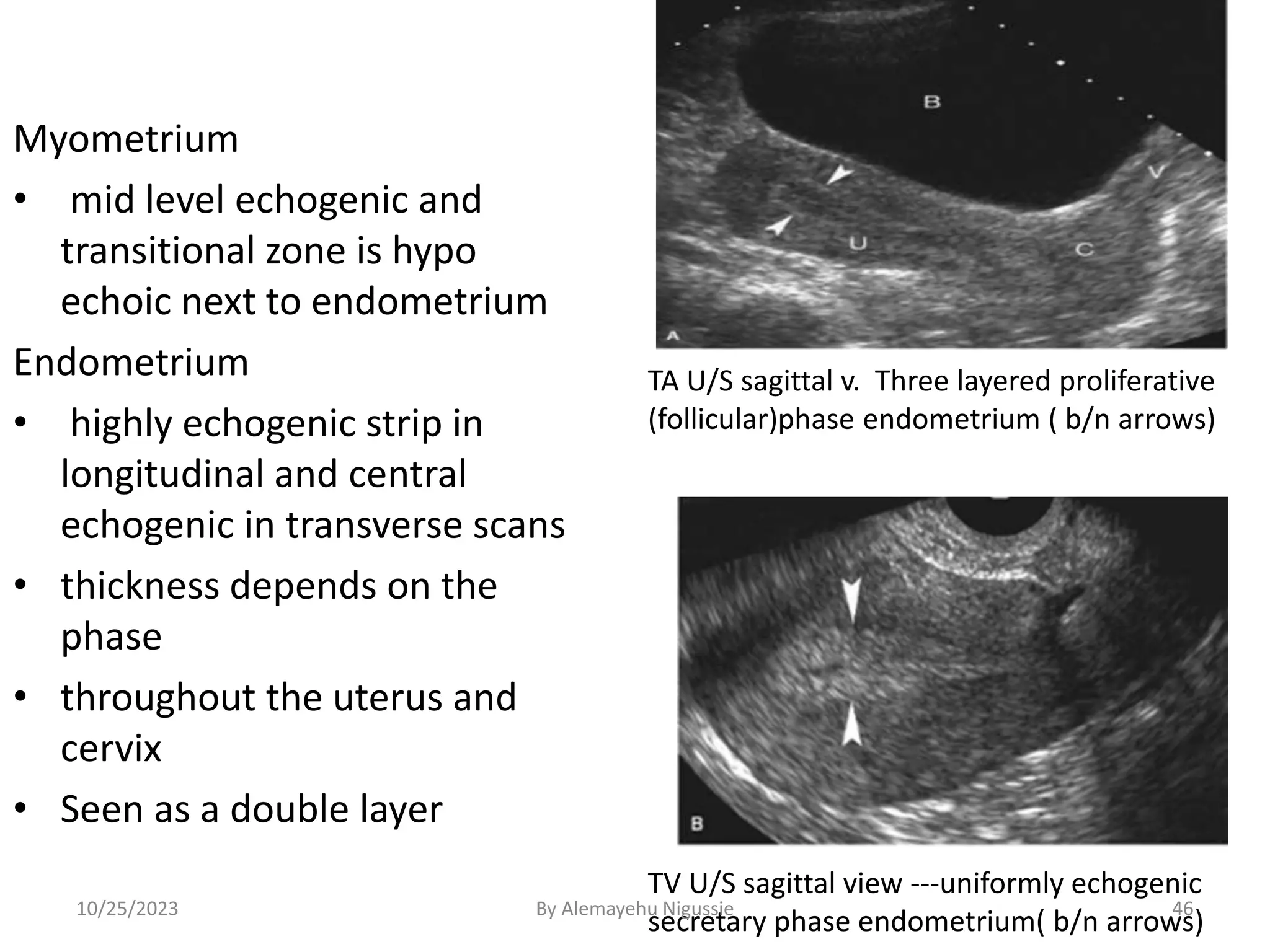 Obstetric Ultrasound final-1.pptx